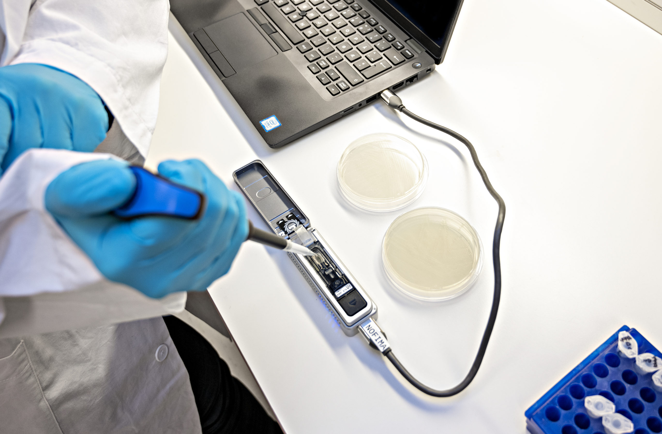 Development of a rapid test for detection of listeria in the ...